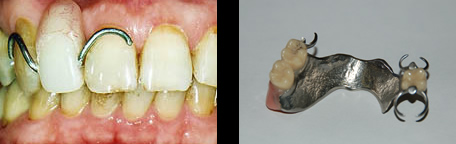 Dentist Coraopolis, PA - Wexford, PA - Greentree, PA - Moon Plaza, PA ...